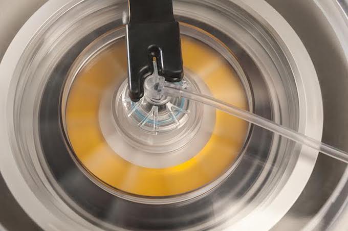 Platelet rich plasma | The Maitland Clinic